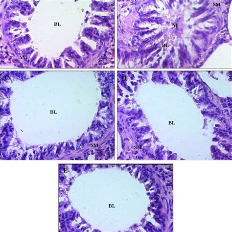 Photomicrographs Of Hematoxylin Eosin Stained Lung Sections From Rats