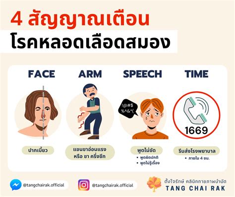 รู้ไว้ก่อน 4 สัญญาณอันตราย โรคหลอดเลือดสมอง ตั้งใจรักษ์ คลินิกกายภาพบำบัด