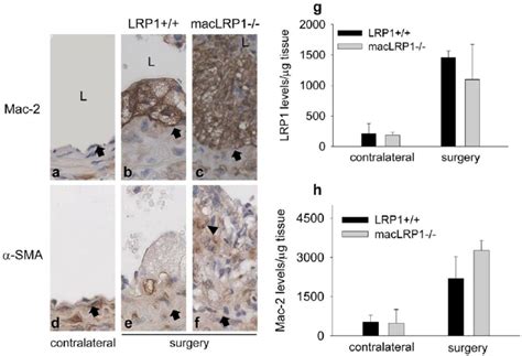 Immunohistochemical Analysis Of Macrophage And A Smc Actin Positive