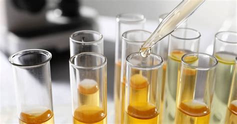 The Silent Warning Hiding In Your Thyroglobulin Antibody Test Mitchell Holistic Health