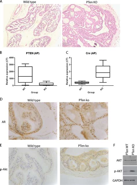 Characterisation Of The Pten Deletion Mouse Prostate Tissue A