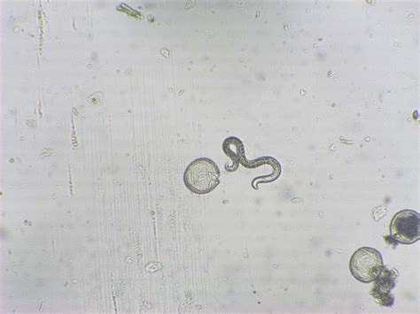 Toxocara Canis Egg