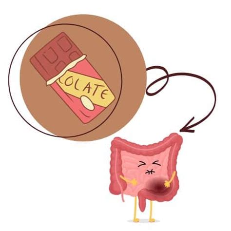Can Chocolate Cause Constipation [march]