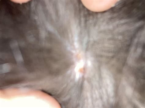 Does This Look Like Ringworm Rcats
