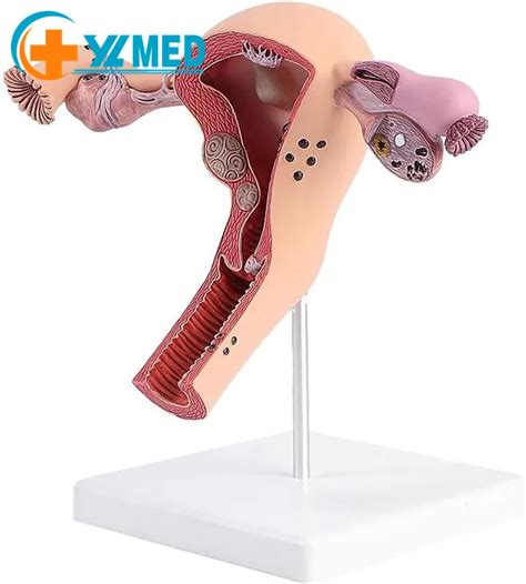 Teaching Learning Tool Gynecological Uterus Structure Anatomy Model