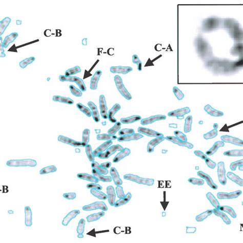 Typical Karyotypic Abnormalities Obtained After 48 H Of Wt Myc Protein Download Scientific