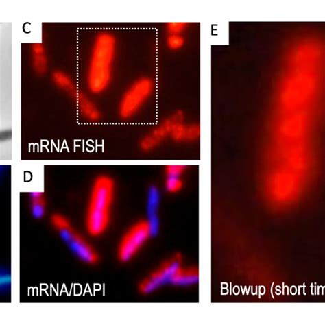 Effect Of Modulated Macromolecular Crowding By Inhibiting Bacterial