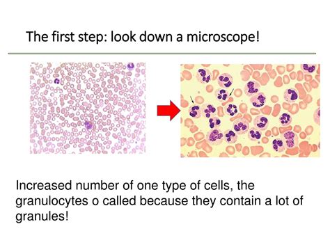 Ppt Molecular Monitoring In Cml Diagnostic Tests And Treatment Decision Support Powerpoint