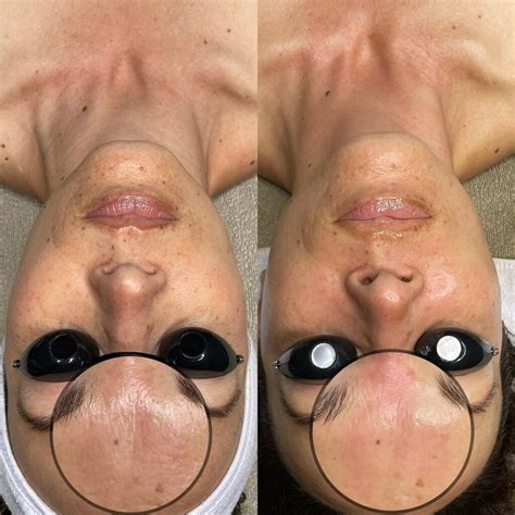 Introducing Dmk Stemzyme™ Dmk Uk