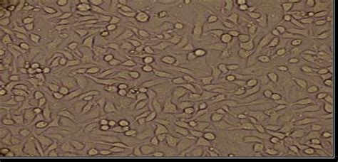 Control Non Infected Vero Cells Line After 3days On Eagle Minimal