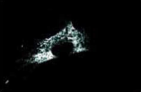 Purified Mouse Anti Calreticulin