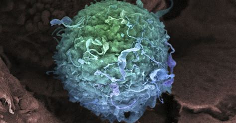 Breast Cancers Achilles Heel Discovered By Scientists Which Could