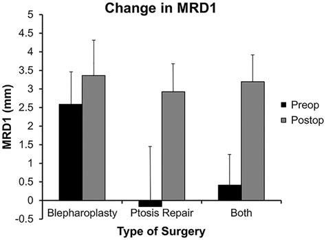 Tangent Screen Perimetry In The Evaluation Of Visual Field Defects Associated With Ptosis And