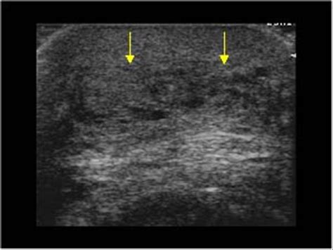 Musculoskeletal Joints And Tendons 6 8 Foot Case 6 8 2 Bursitis