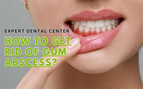 How Do You Get Rid Of A Gum Abscess