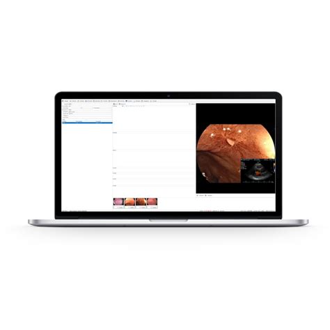 Ultrasound Endoscopy Medical Imaging Workstation Manufacturer