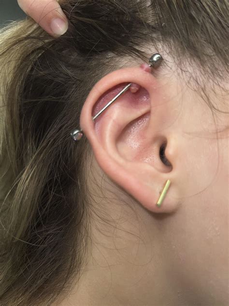 Piercing Bump Or Keloid Need Help With Healing Process Rpiercing
