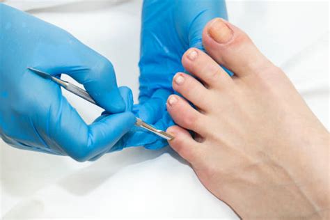 How To Grow Your Nails Faster And Stronger Everything You Need To Know