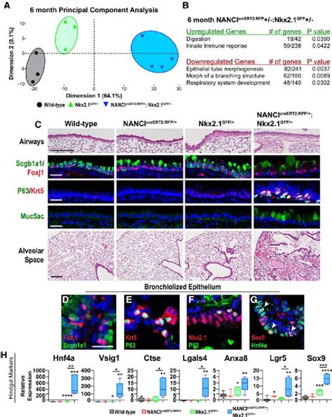 Progressive Pulmonary Degeneration And Lineage Reprogramming In 6 Moold