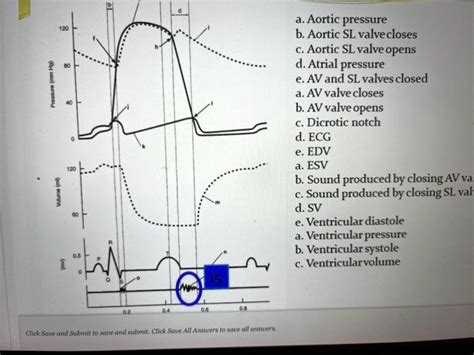 Aortic Pressure B Aortic Sl Valvecloses Aortic Sl Valve Opens D Atrial
