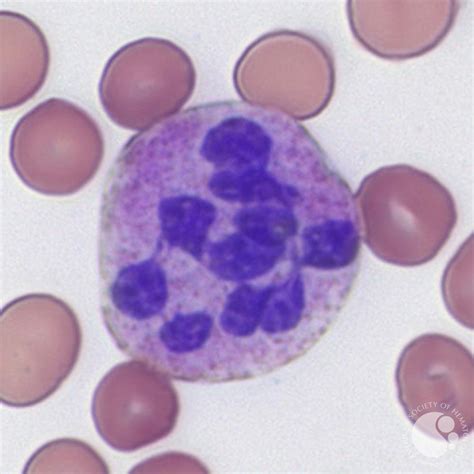 รายการ 90 ภาพ Neutrophil คือค่าอะไร อัปเดต