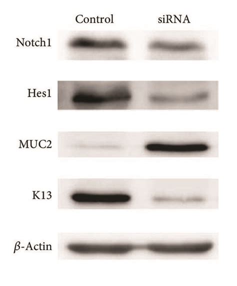Effects Of Notch Signaling Inhibition Expressions Of Notch1 Hes1 And