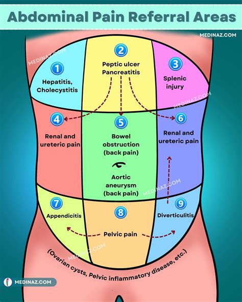 Dr ️ Abdominal Pain Referral Areas Based On Common Conditions