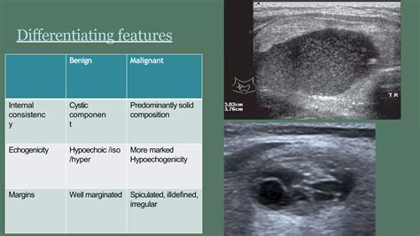 Imaging Of Thyroid Lesionspptx