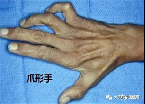 动态新闻 大庆中医医院