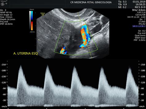 Morfológico 2º Trimestre CR Medicina Fetal