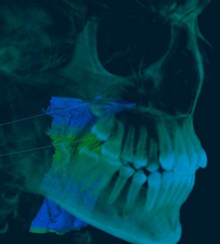 Tusk Tech Sector Tusk Orthodontics