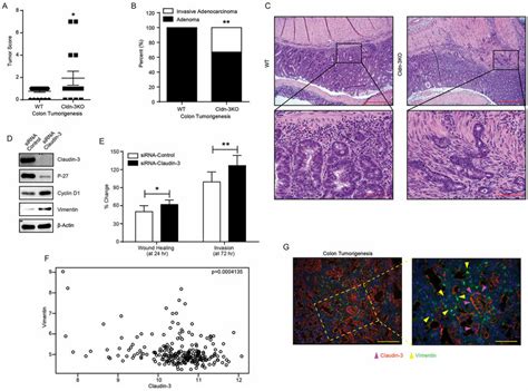 Loss Of Colonic Claudin 3 Induces Cancer Invasiveness And Promotes
