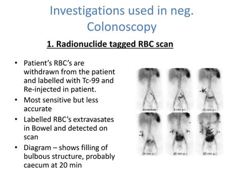 Approach To A Patient With Gi Hemorrhage Ppt