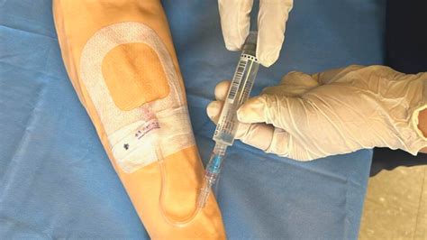 Diplomado En Accesos Vasculares Y Terapia De Infusión