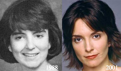 Tina Fey Plastic Surgery Tina Fey Scar Before And After Photos