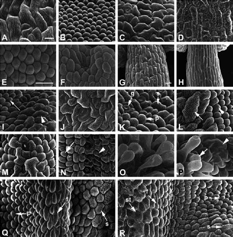 Surface Cells Of Normal And Different Chimeric Organs From Ask11
