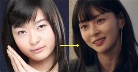 クォンナラは整形してる？整形前と言われる昔の画像や真相を紹介