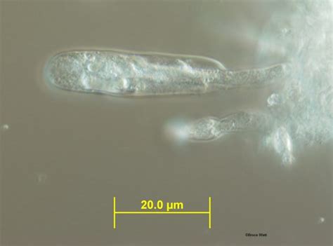 Pine Sphaeropsis Diplodia Cooperative Extension Insect Pests