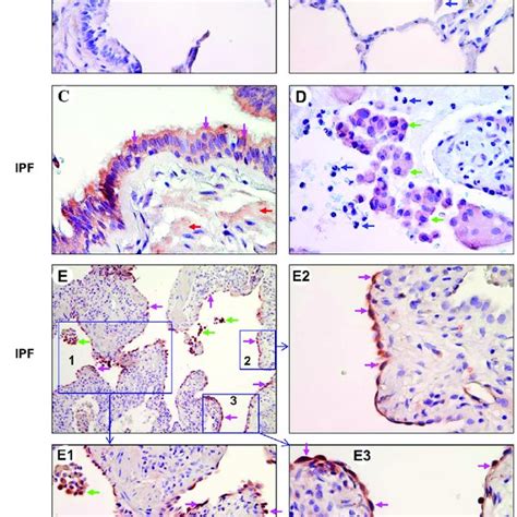 Integrin activation of TGF β can occur via αVβ A and αVβ B Download Scientific Diagram