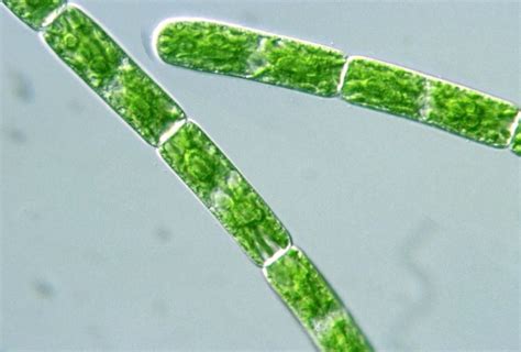 Protist Images Cylindrocystis Brebissonii