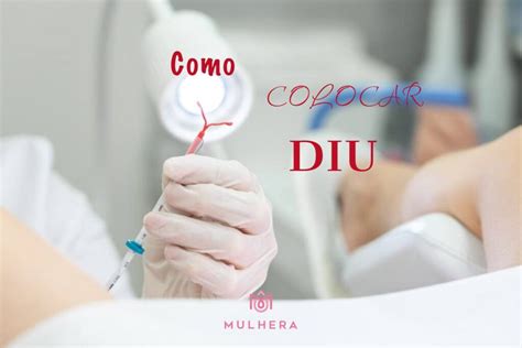 Diu Como Colocar Mulhera