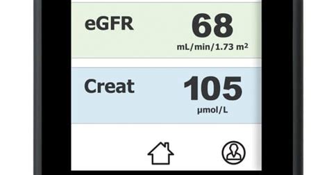 Ce Marked Nova Max Pro Creatinineegfr Meter Launched In Eu Cap Today