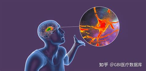 亨廷顿舞蹈症遗传吗？亨廷顿舞蹈症的遗传特点是什么？ 知乎