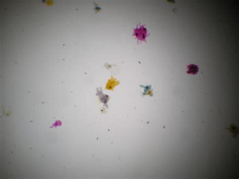 Microscope Practical Flashcards Quizlet