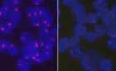 Sex Chromosomes To Blame For Women S Risk Of Autoimmune Diseases