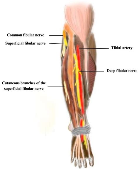 Diagnostic Approach To Lower Limbs Entrapment Neuropathies A Narrative