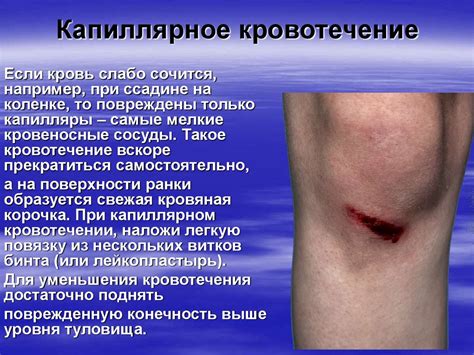 Травматические повреждения лекция 1 презентация онлайн