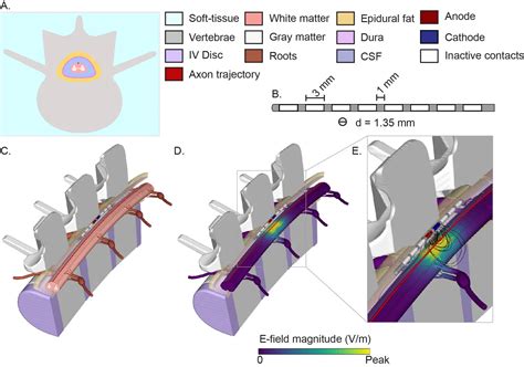 New Paper Role Of Frequency Dependent And Capacitive Tissue Properties In Spinal Cord