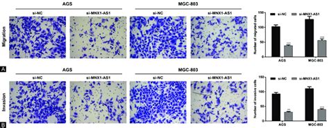 Effects Of Mnx1 As1 Knockdown On The Migration And Invasion Of Gastric