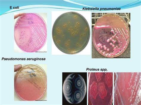 Best Antibiotic For Klebsiella Pneumoniae